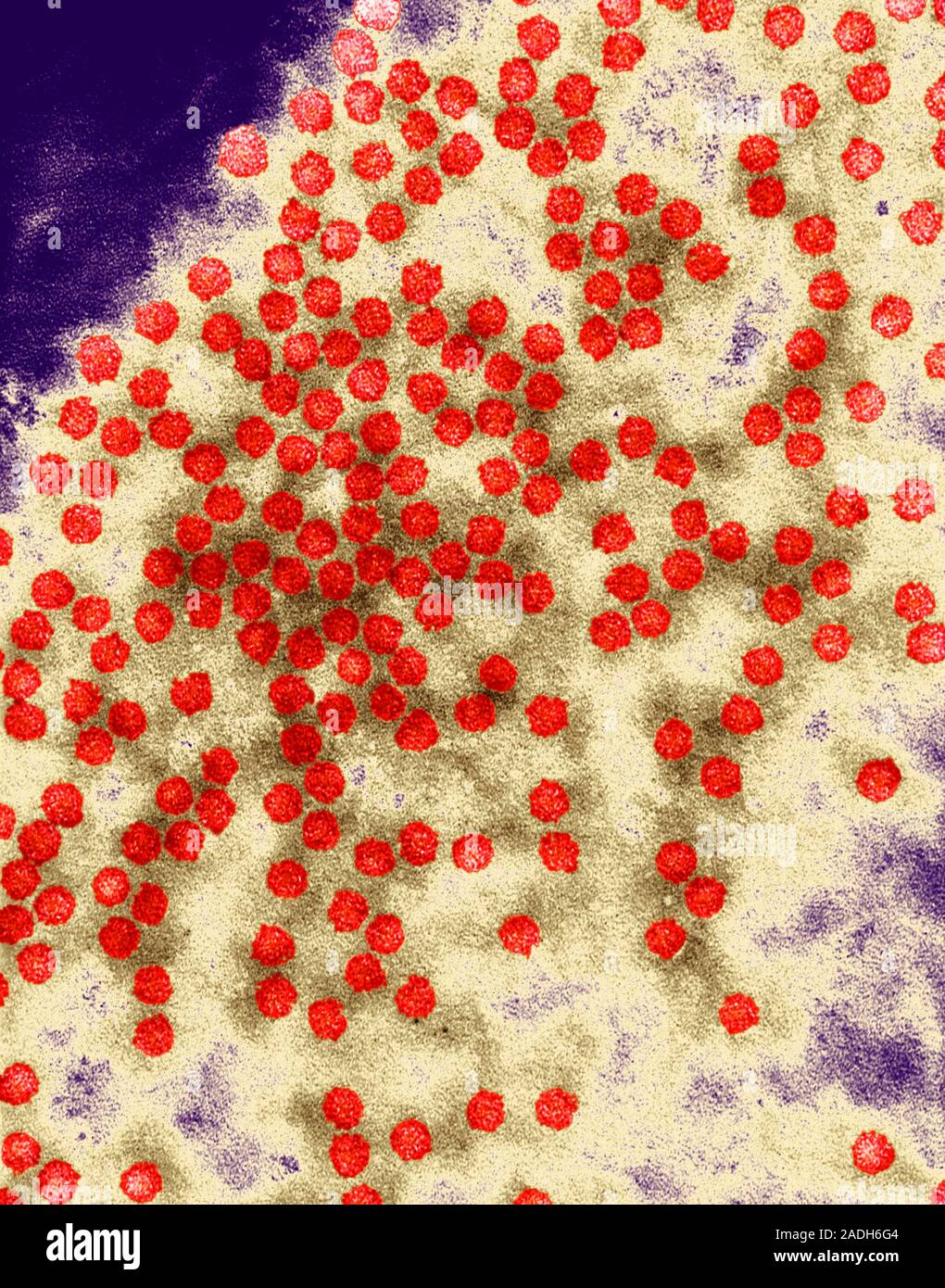 Cucumber mosaic virus. Coloured transmission electron micrograph (TEM ...