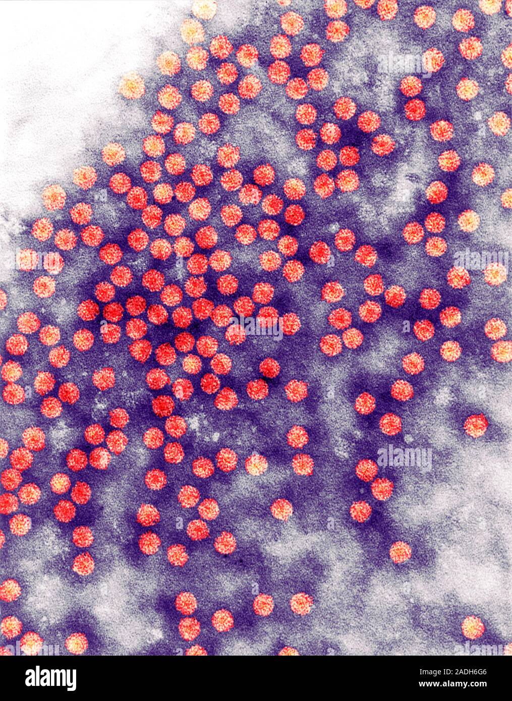 Cucumber mosaic virus. Coloured transmission electron micrograph (TEM ...