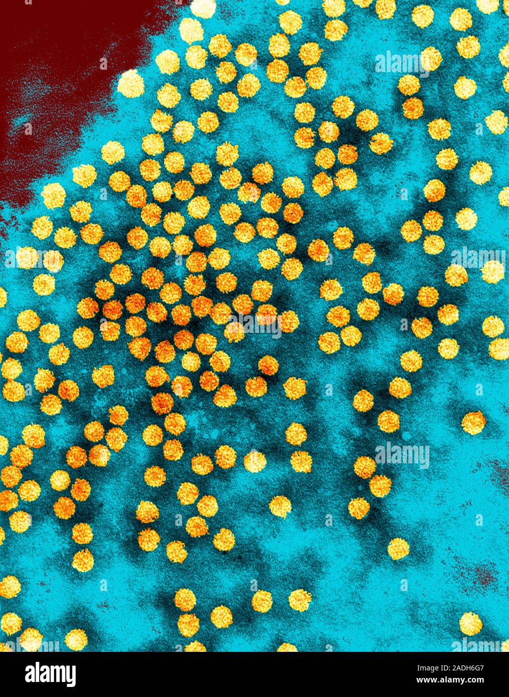Cucumber mosaic virus. Coloured transmission electron micrograph (TEM ...