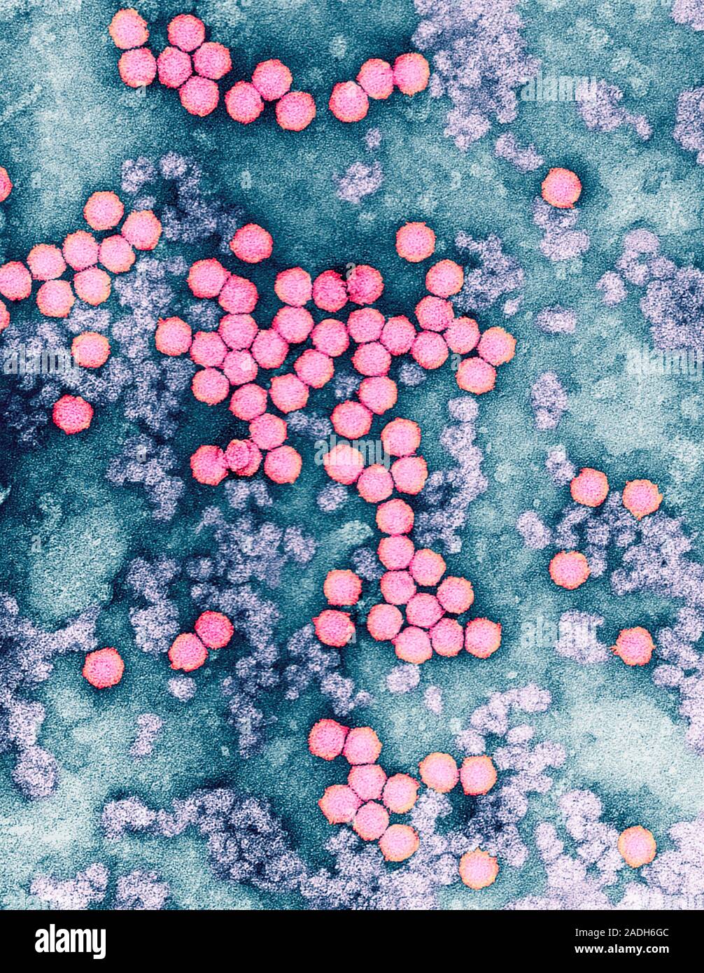 Parsnip yellow fleck virus. Coloured transmission electron micrograph ...