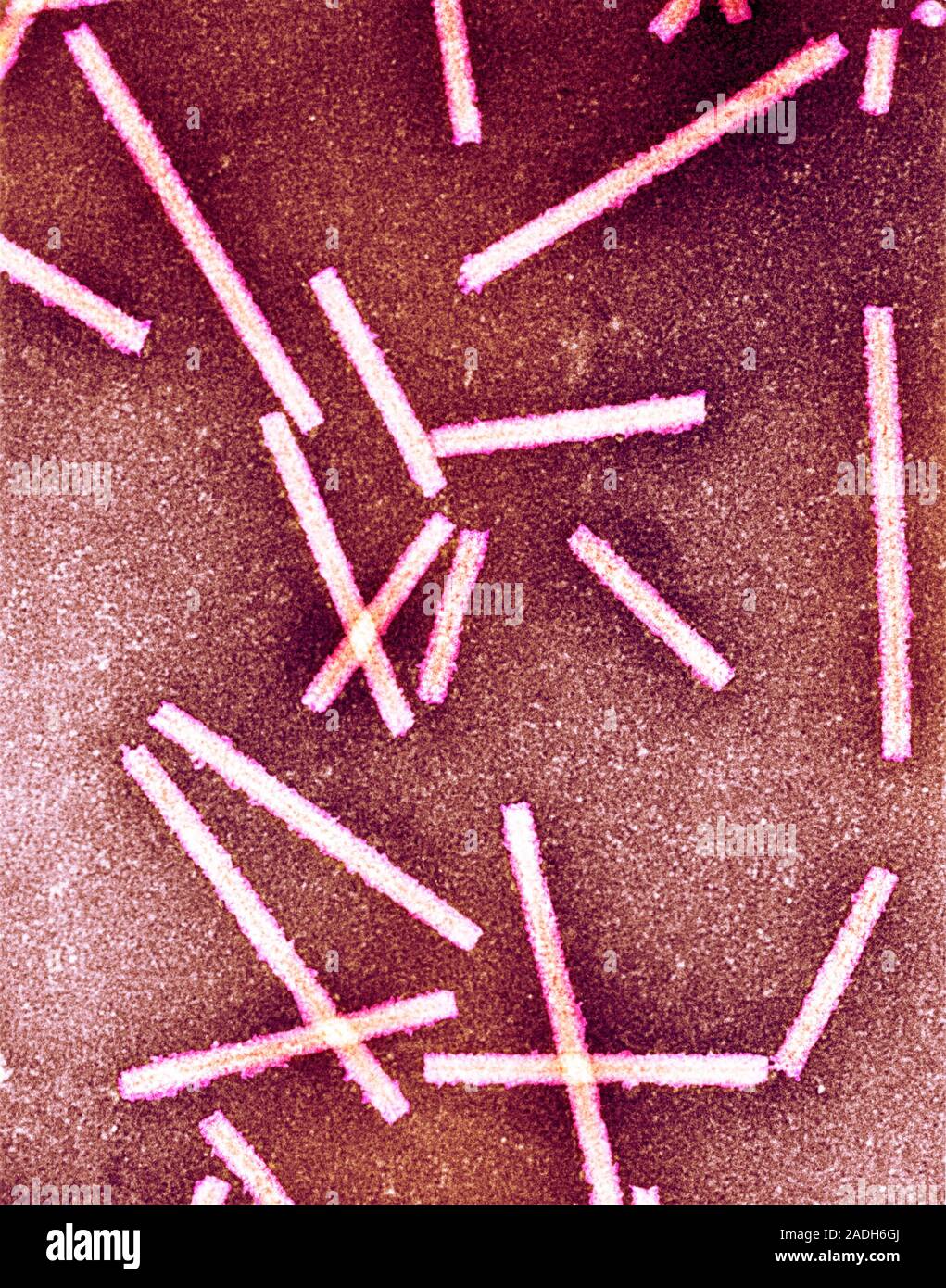 Potato mop top virus. Coloured transmission electron micrograph (TEM ...