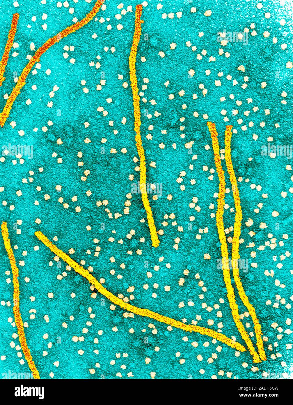 Potato X virus. Coloured transmission electron micrograph (TEM) of ...