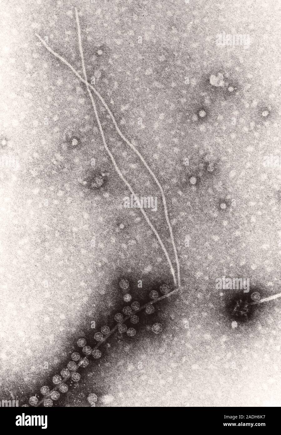 Transmission electron micrograph of bacteriophages (phage f1 & f2) on a ...