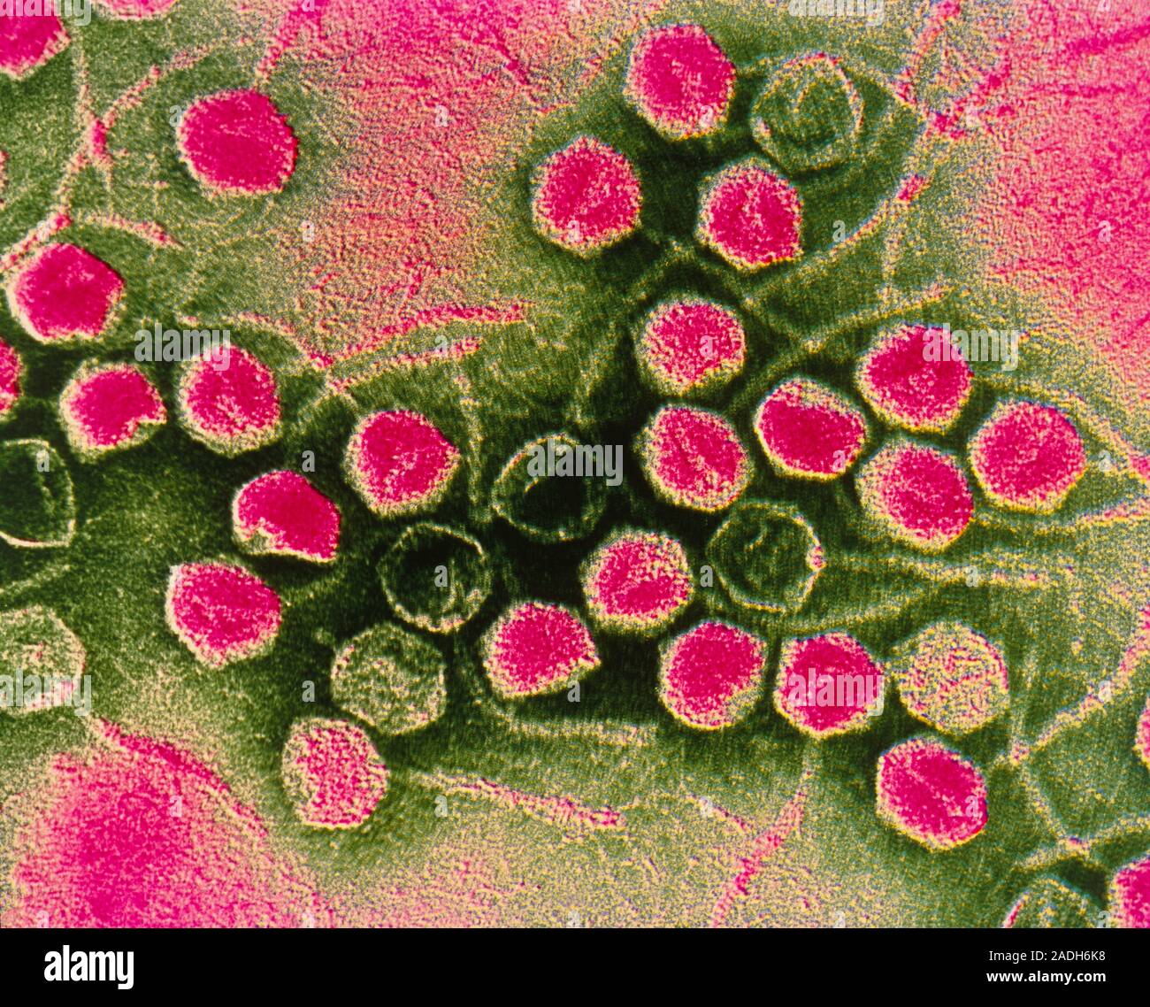 False Colour Transmission Electron Micrograph Tem Of Lambda Bacteriophages Phages A Type Of