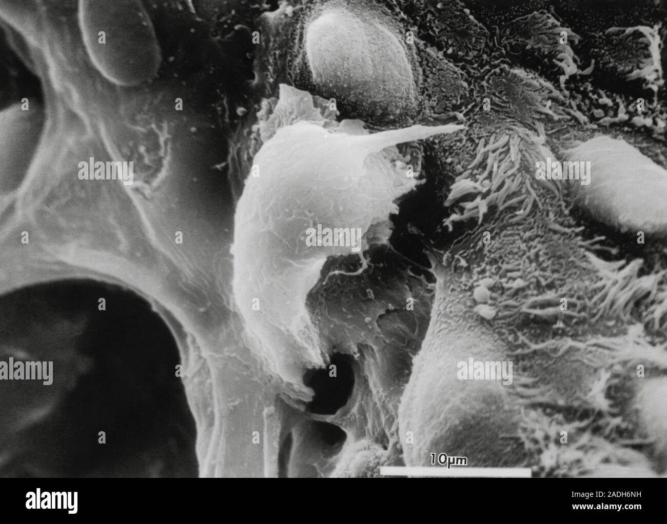 Scanning electron micrograph of a macrophage migrating from the alveoli ...