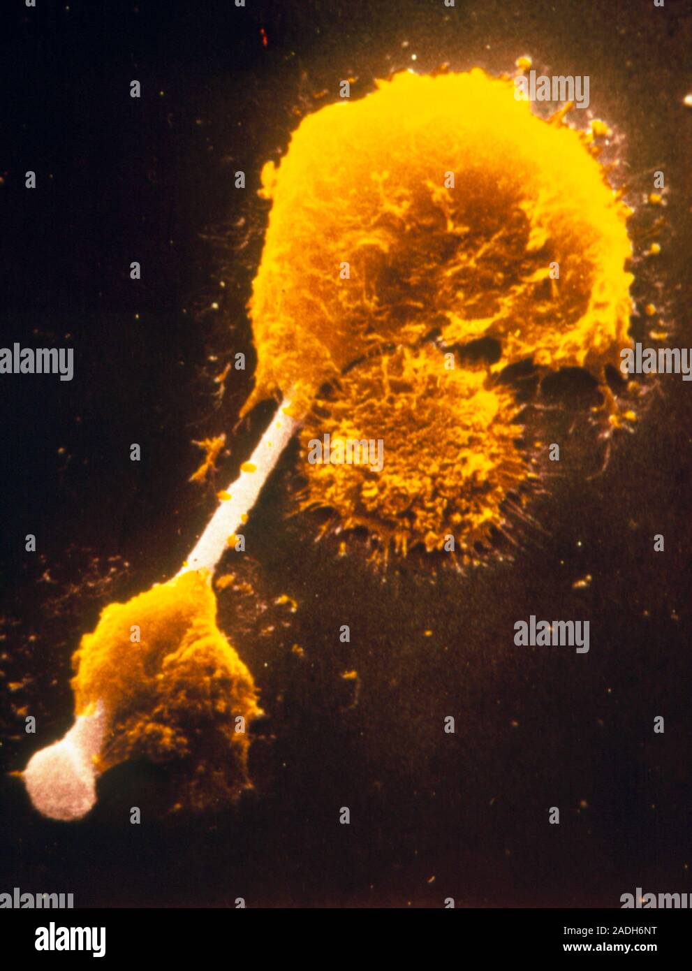 False-colour scanning electron micrograph of a macrophage impaled on an ...