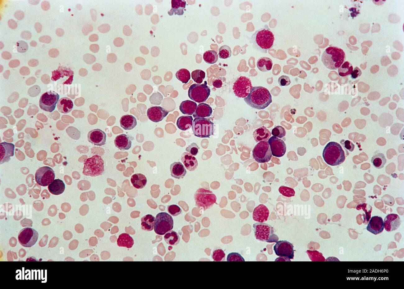 Light micrograph of bone marrow cells showing precursor red (faint red ...