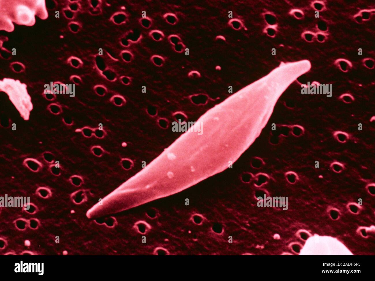 Scanning electron micrograph (SEM) of a deformed red blood cell in ...