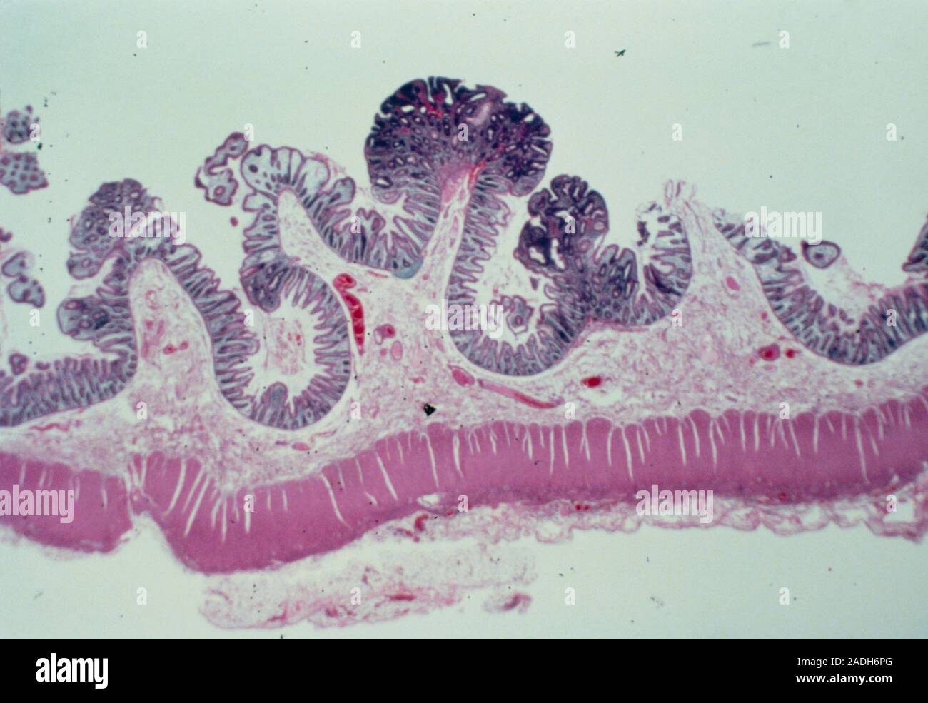 Light micrograph of a section through the human colon, showing two ...