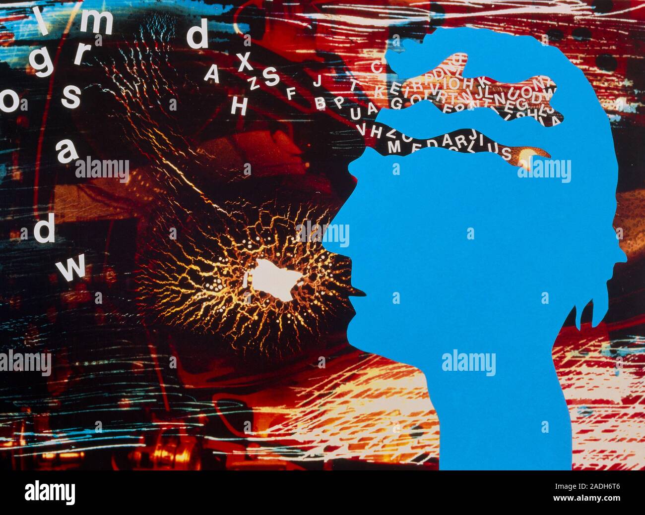 Alzheimer's disease. Abstract collage artwork depicting the effects on ...
