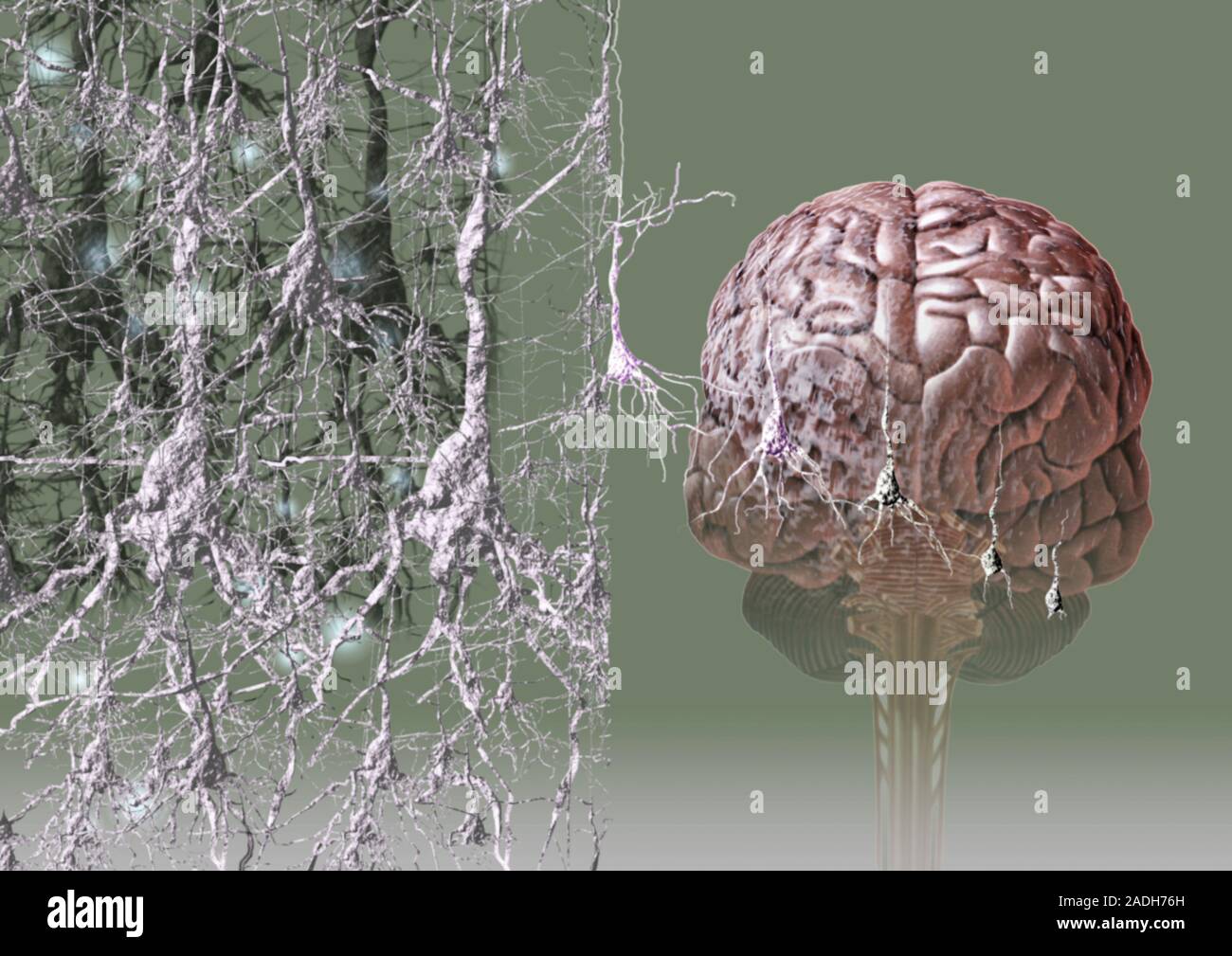 Alzheimer's disease. Conceptual computer artwork of a brain affected by ...