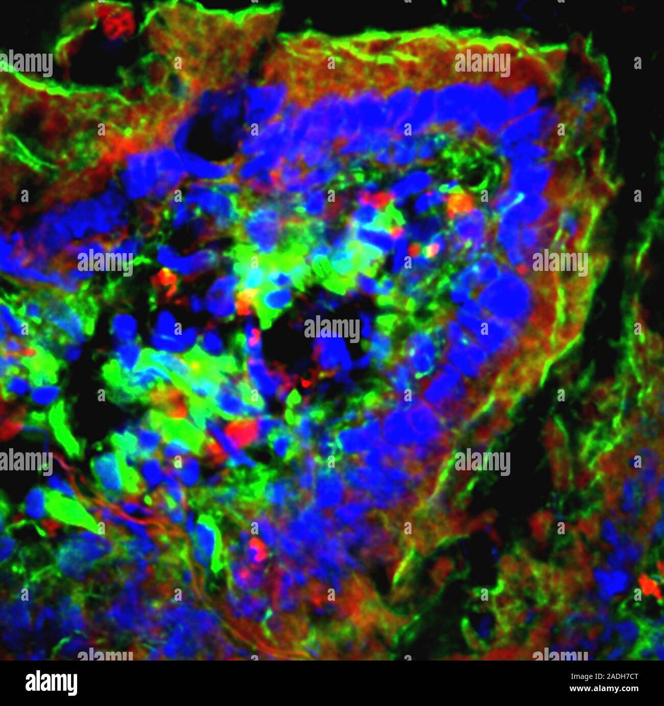 Alcohol-damaged villus, fluorescence deconvolution micrograph ...