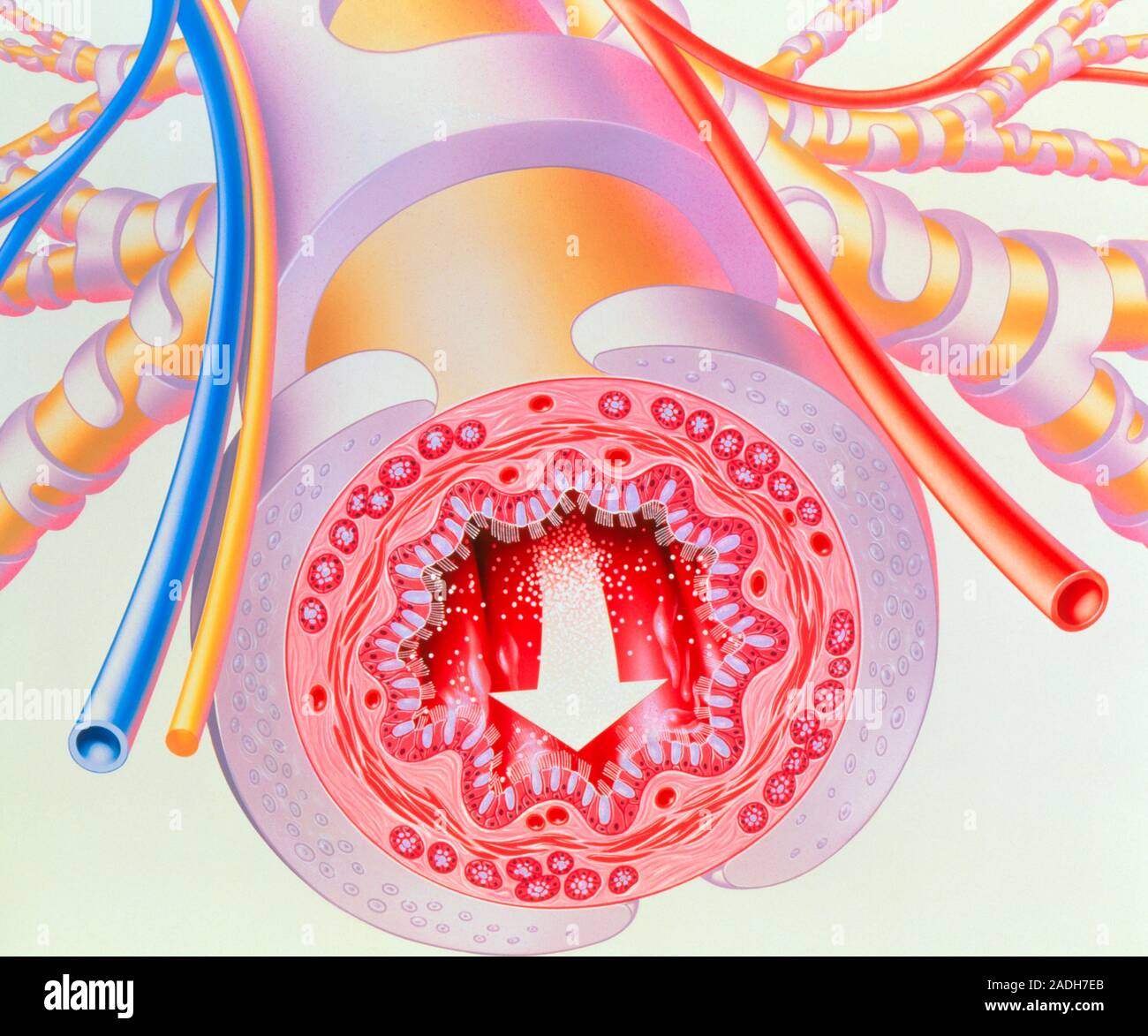 Bronchodilators in asthma. Illustration of an inhaled bronchodilator ...