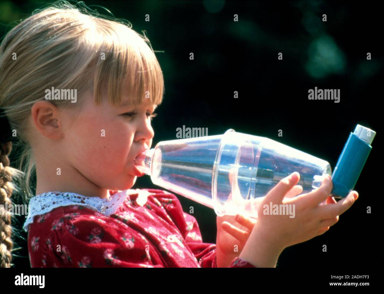 Volumatic asthma inhaler. A girl with asthma uses an inhaler with a ...