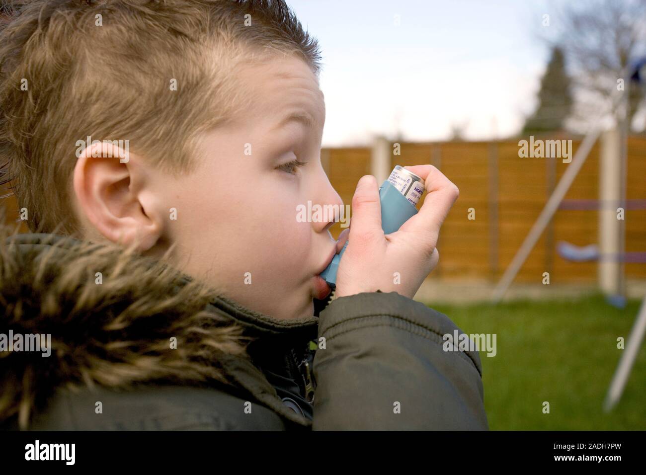 Asthma inhaler use. Young boy using a blue inhaler to treat an asthma ...