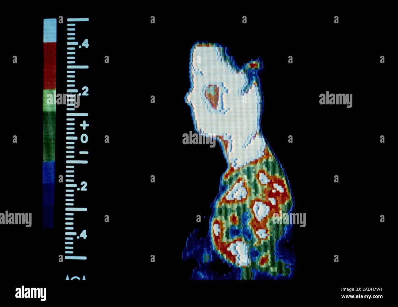 Thermogram of a profile view of the head & shoulders of a person ...
