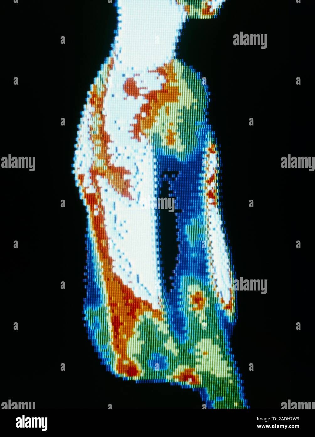 Thermogram of a profile view of the neck & upper body of a person ...