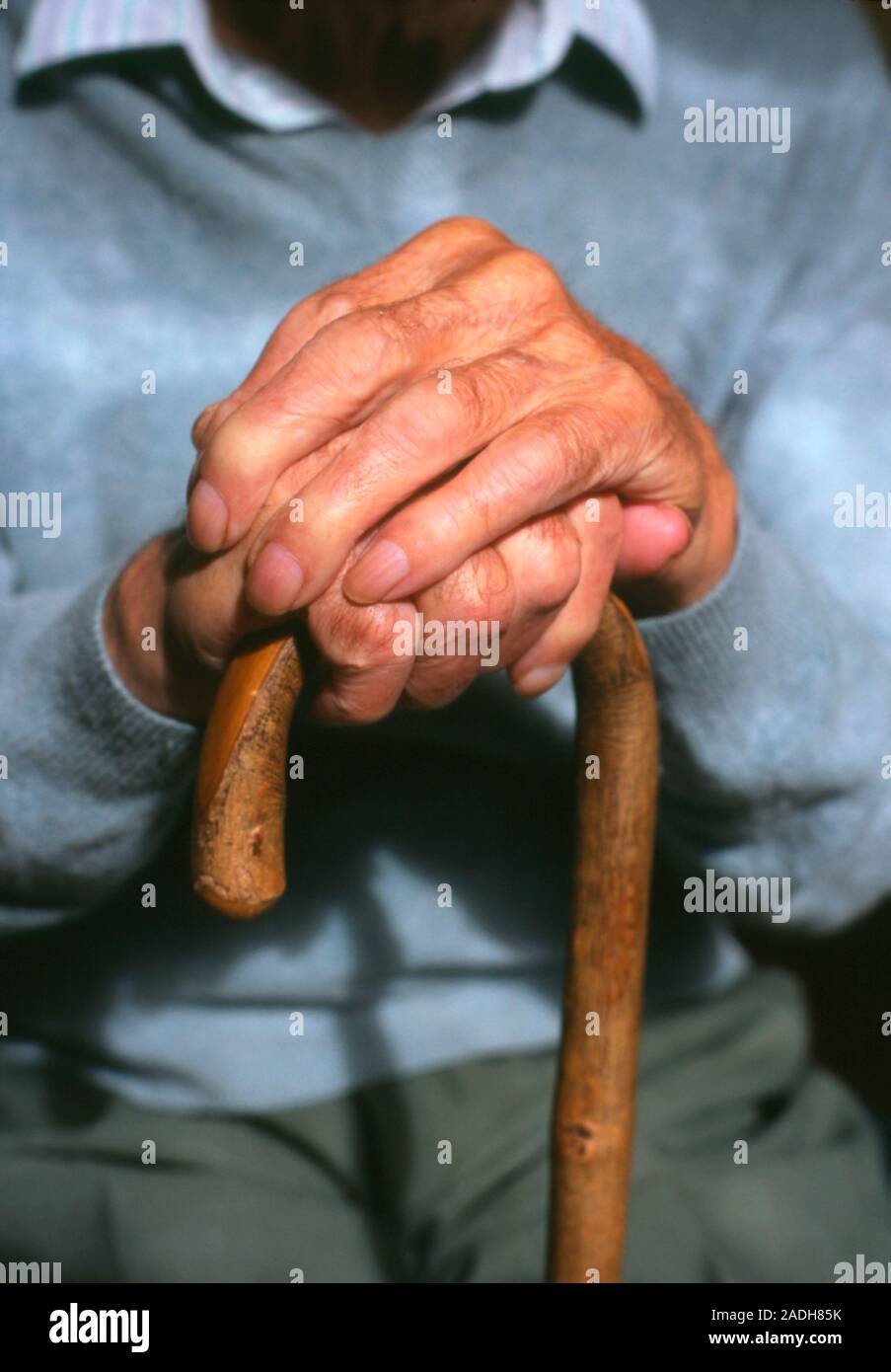 Arthritic hands. Arthritic hands of an elderly man clutching a walking ...