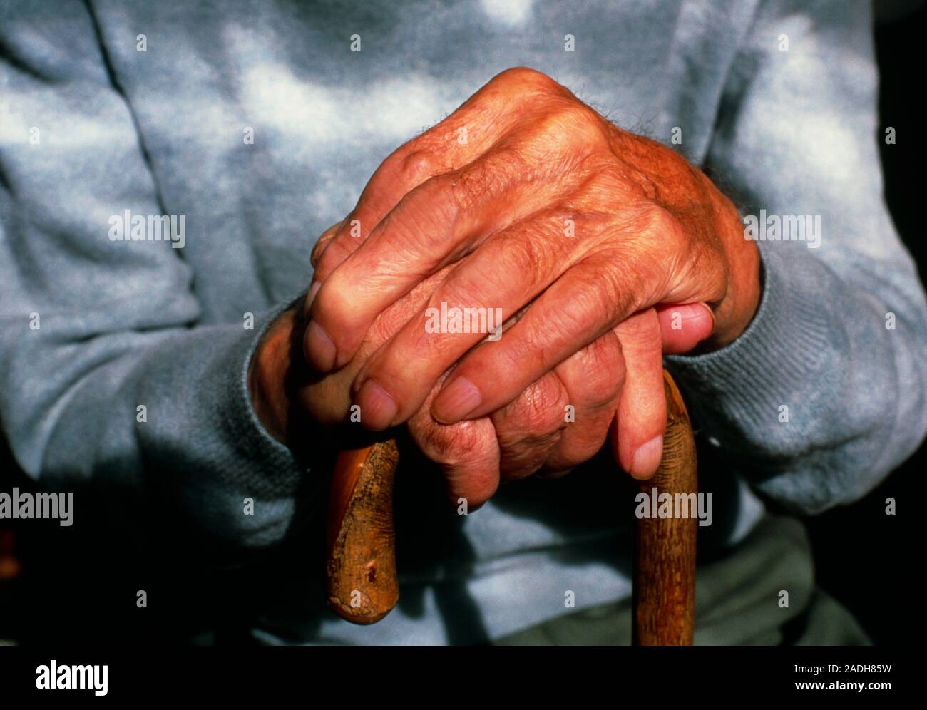 Arthritic hands. Arthritic hands of an elderly man clutching a walking ...