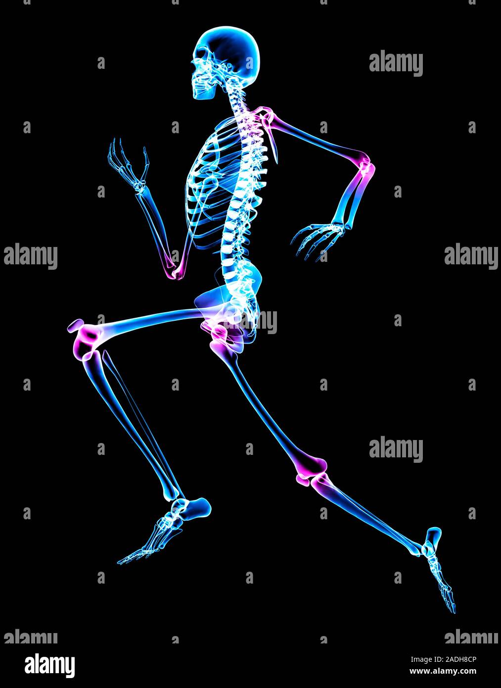 Arthritic joints. Computer artwork of a skeleton, showing arthritic ...
