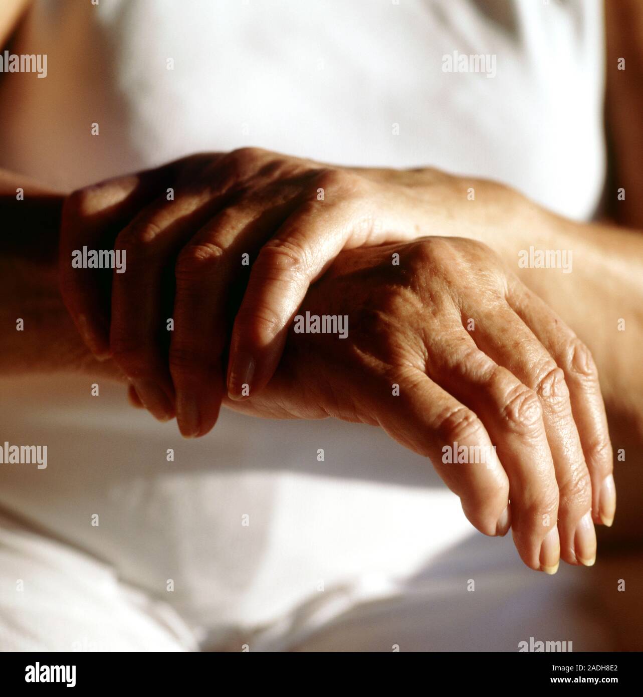 MODEL RELEASED. Elderly woman with osteoarthritis rubbing her sore hand ...