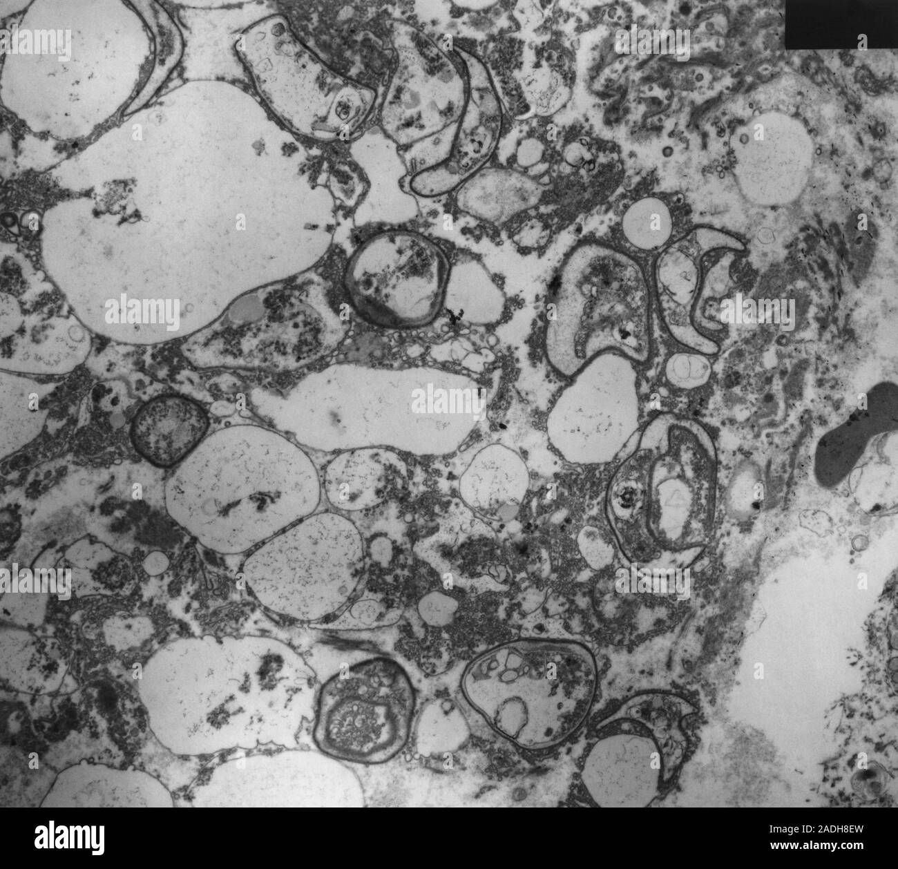Transmission electron micrograph (TEM) of a section of lung tissue from ...