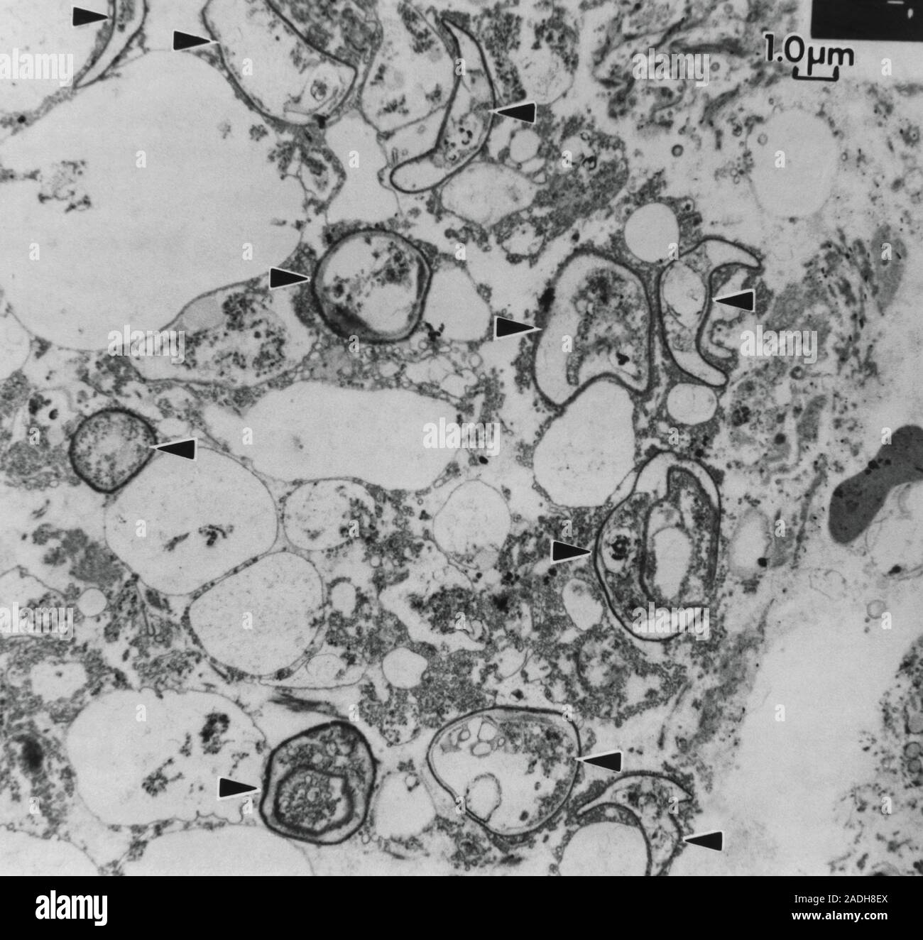 Transmission electron micrograph (TEM) of a section of lung tissue from ...