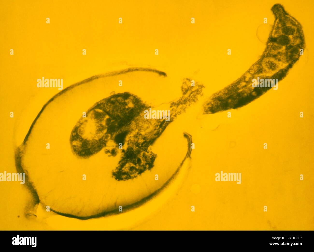 False colour transmission electron micrograph (TEM), showing a stage in ...