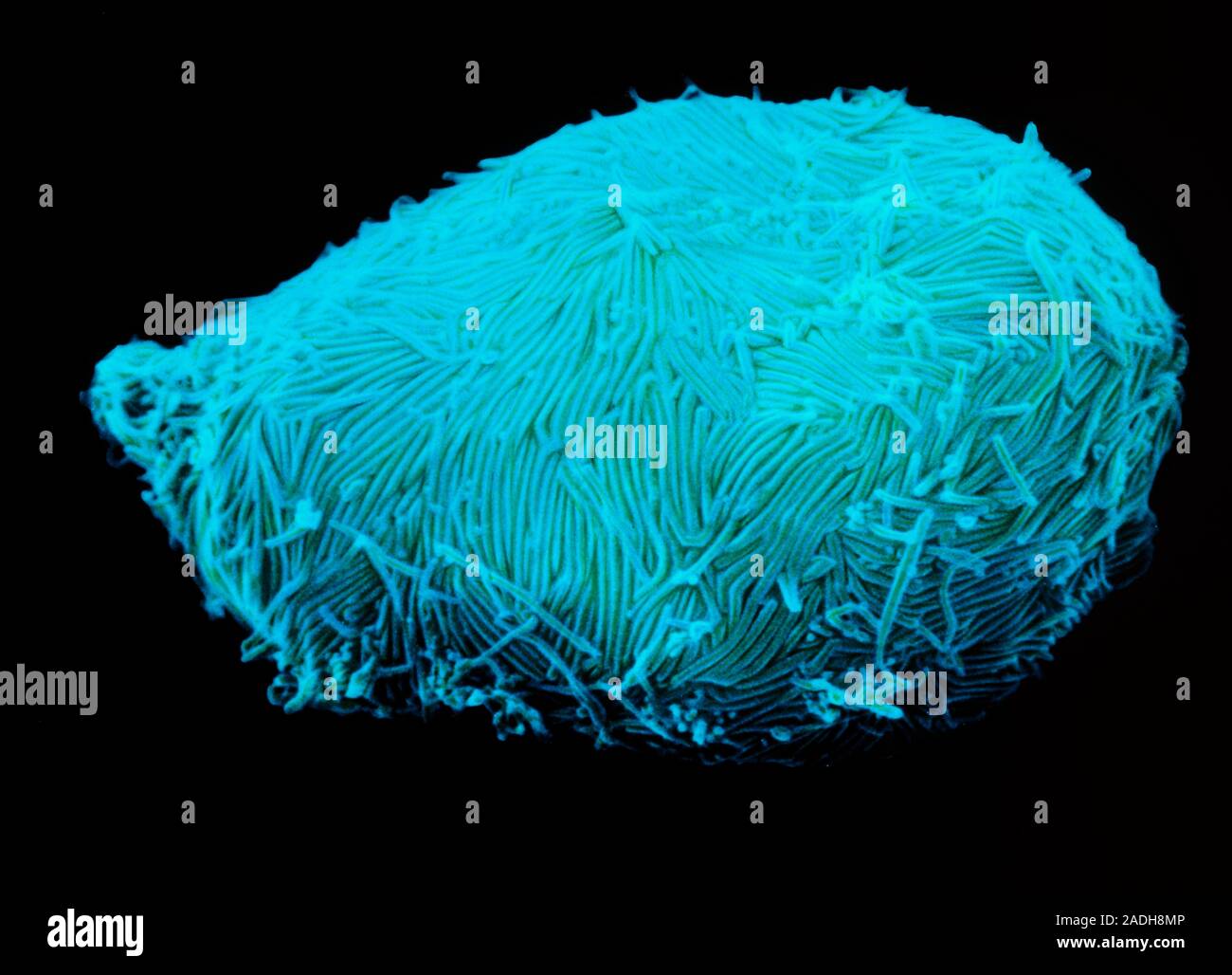 HIV infected white blood cell. Coloured scanning electron micrograph ...