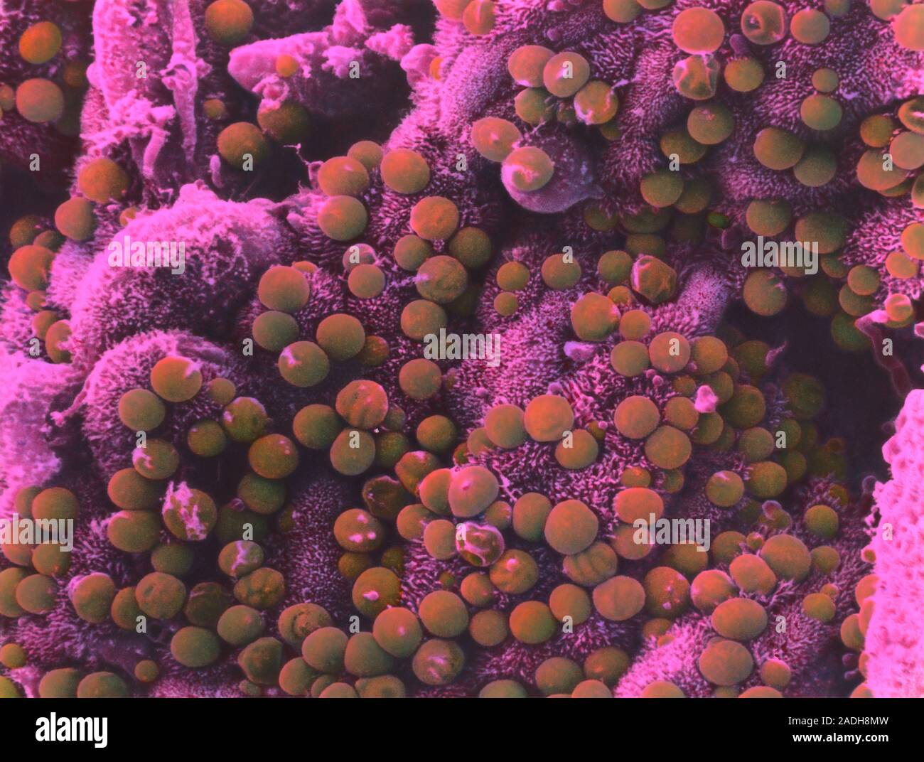 Cryptosporidium parvum. Coloured scanning electron micrograph (SEM) of ...