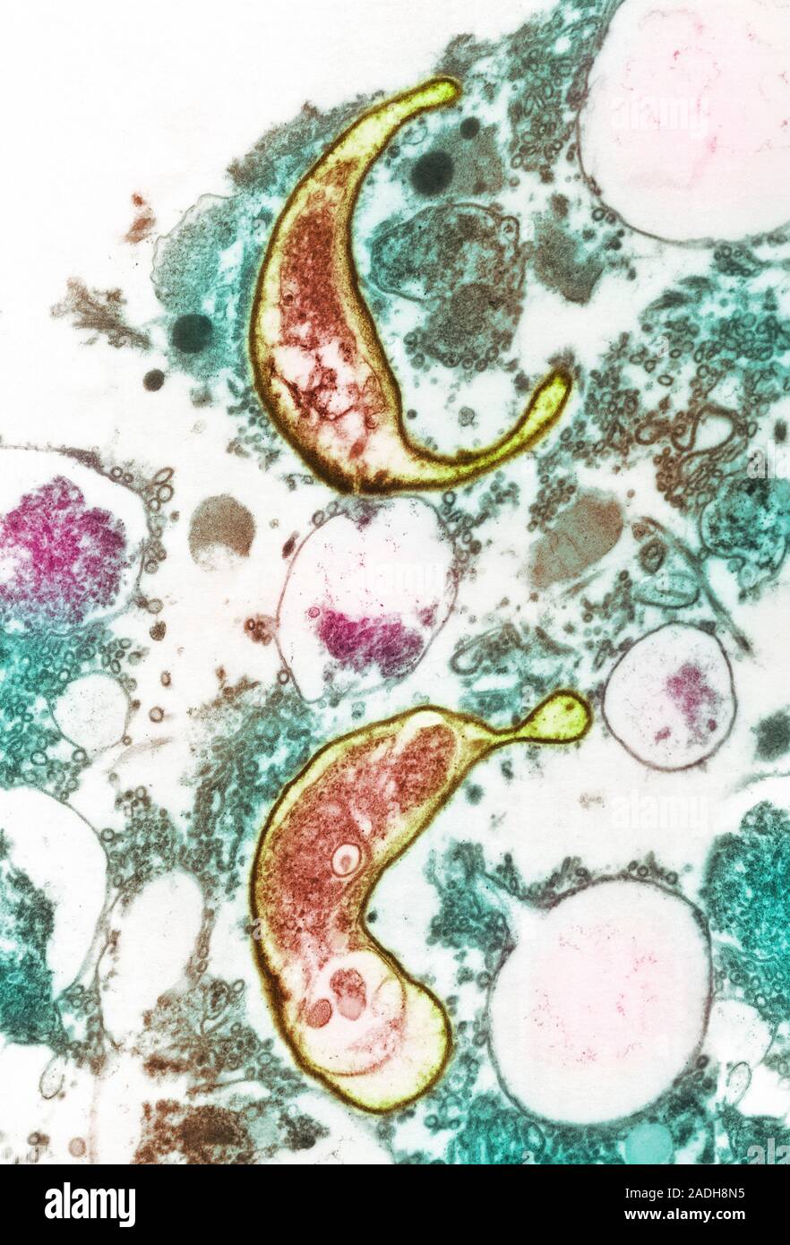 AIDS pneumonia infection. Coloured transmission electron micrograph ...
