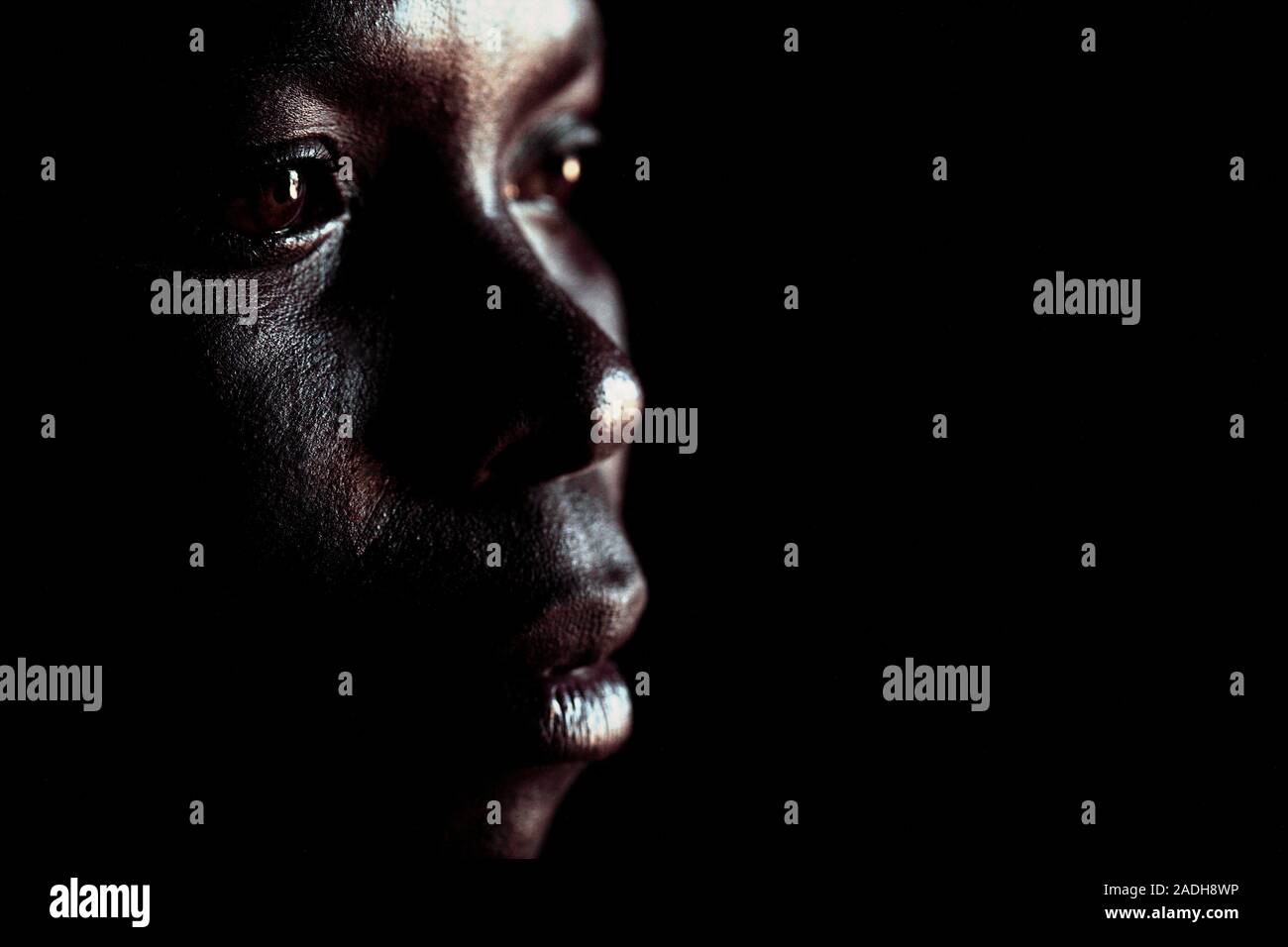 HIV-positive child. This child is infected with the human ...