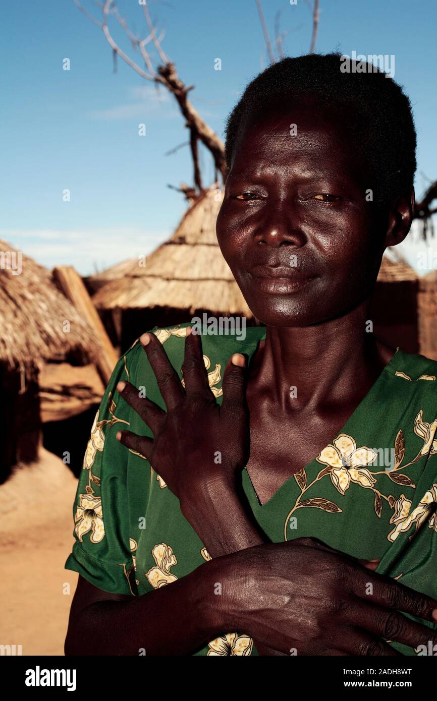 HIV-positive woman. This woman is infected with the human ...