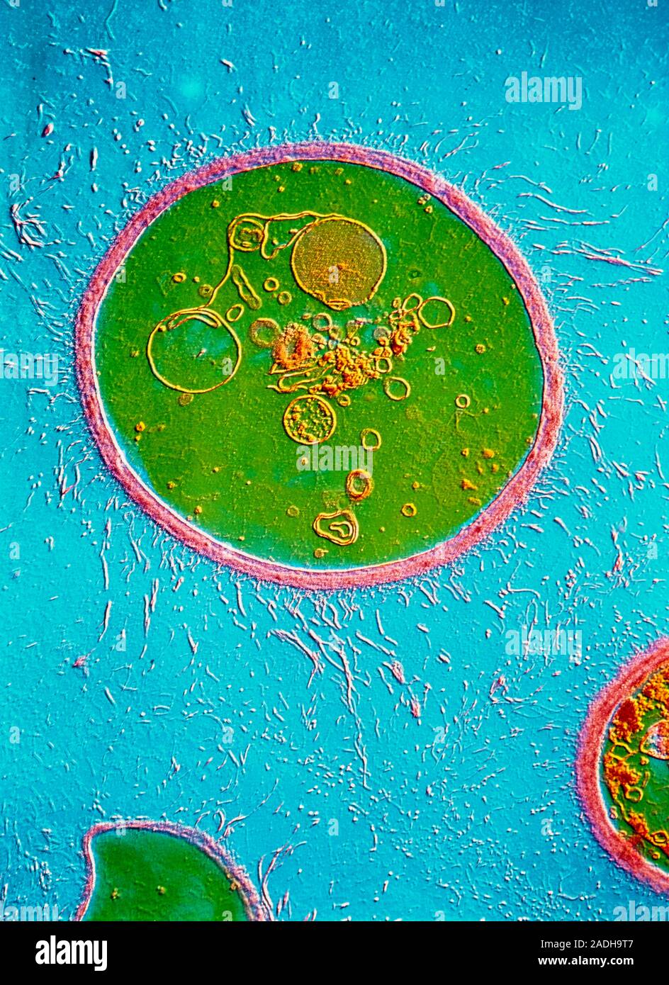 False-colour transmission electron micrograph (TEM) of Cryptococcus ...