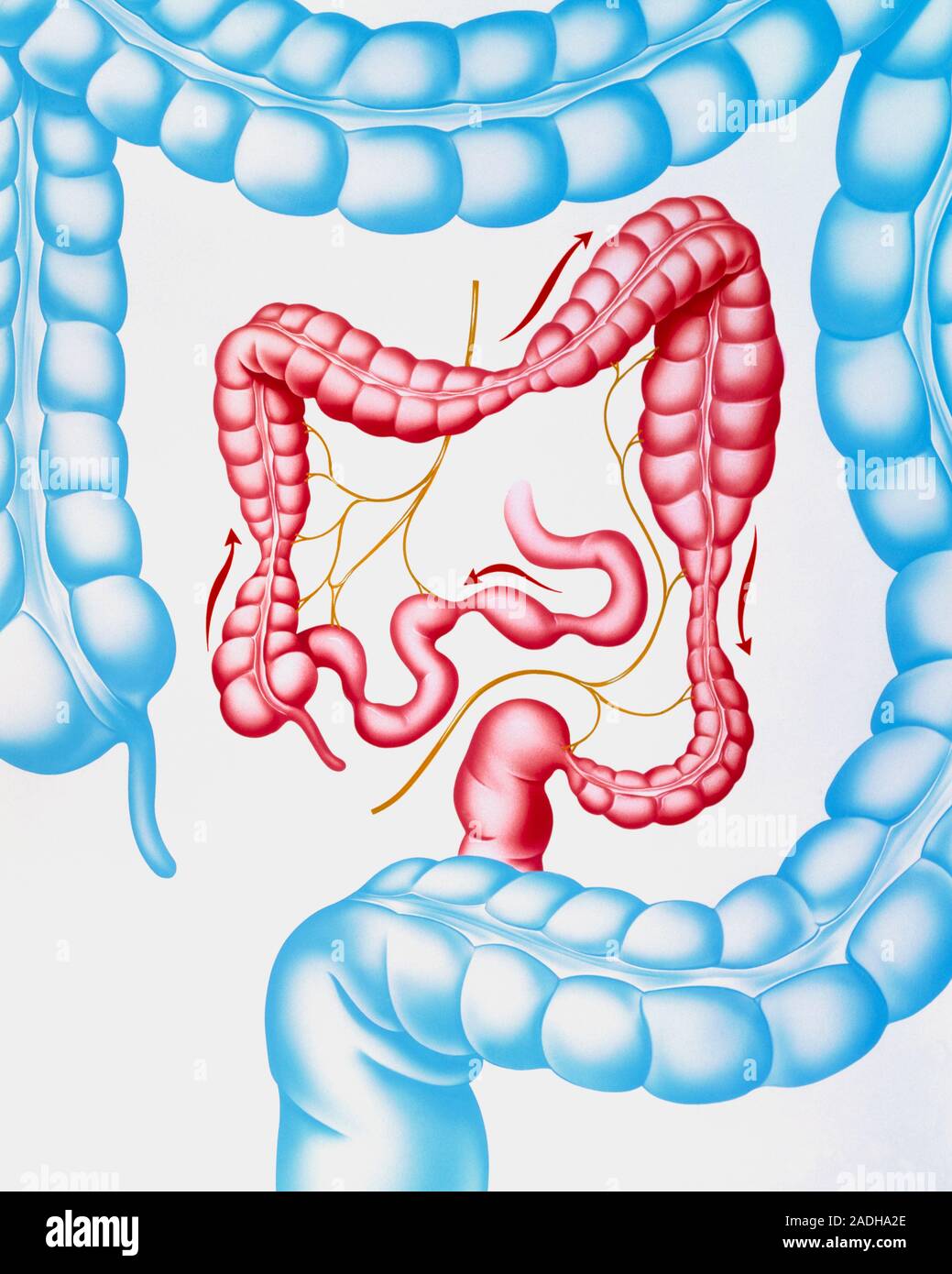 Irritable bowel syndrome. Illustration depicting irritable bowel ...