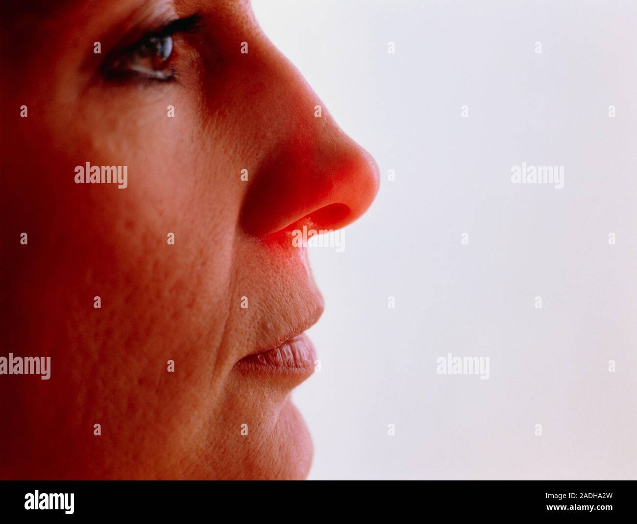 Running nose. Profile of a woman's face with her running nose ...