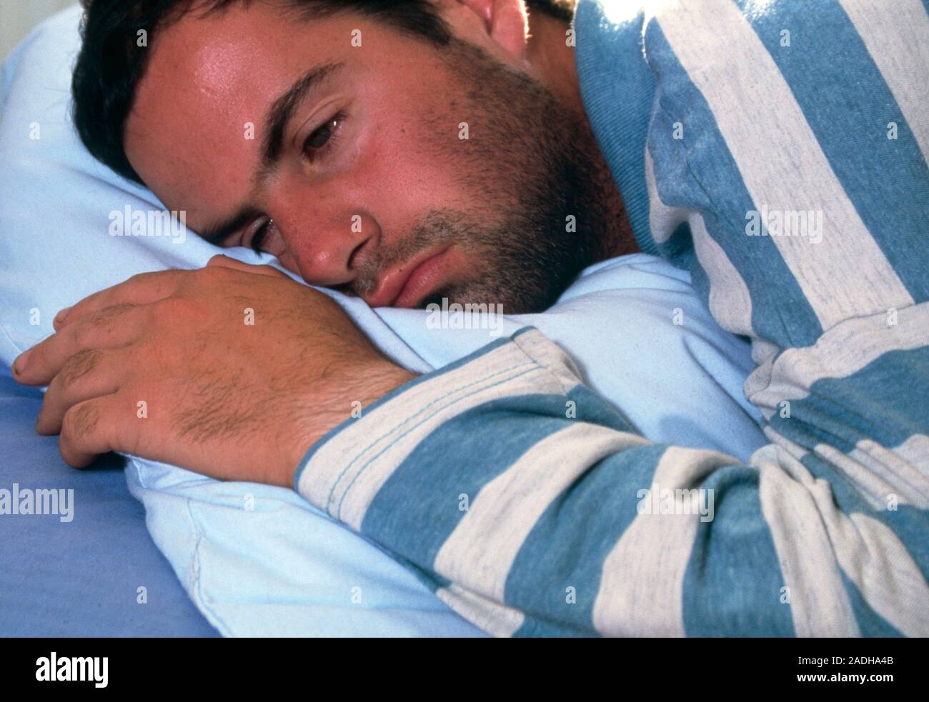 Common cold. A feverish man suffering from the common cold lies in bed ...