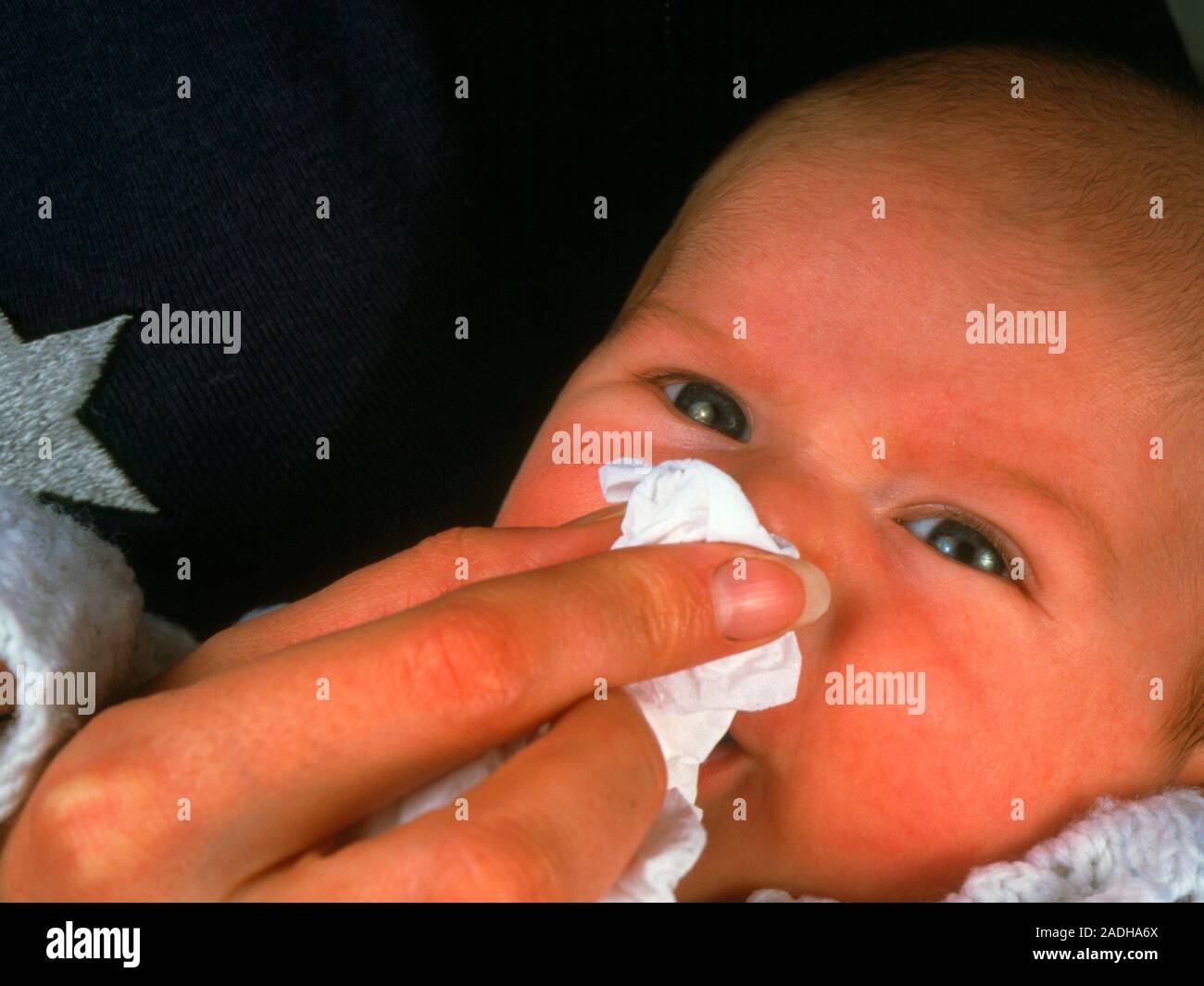 Common cold. Close-up of a mother wiping the nose of her baby who is ...
