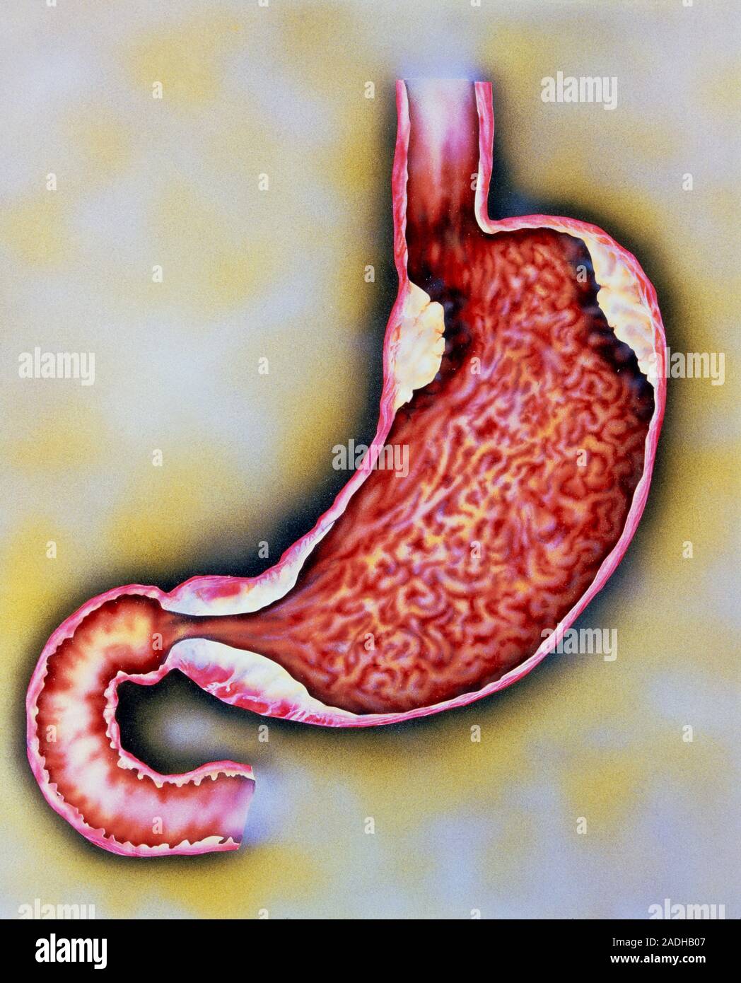 Illustration of the three most common locations of cancer in the ...