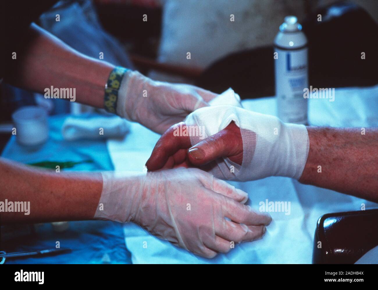 Skin cancer. District nurse dressing the hand of an elderly patient ...