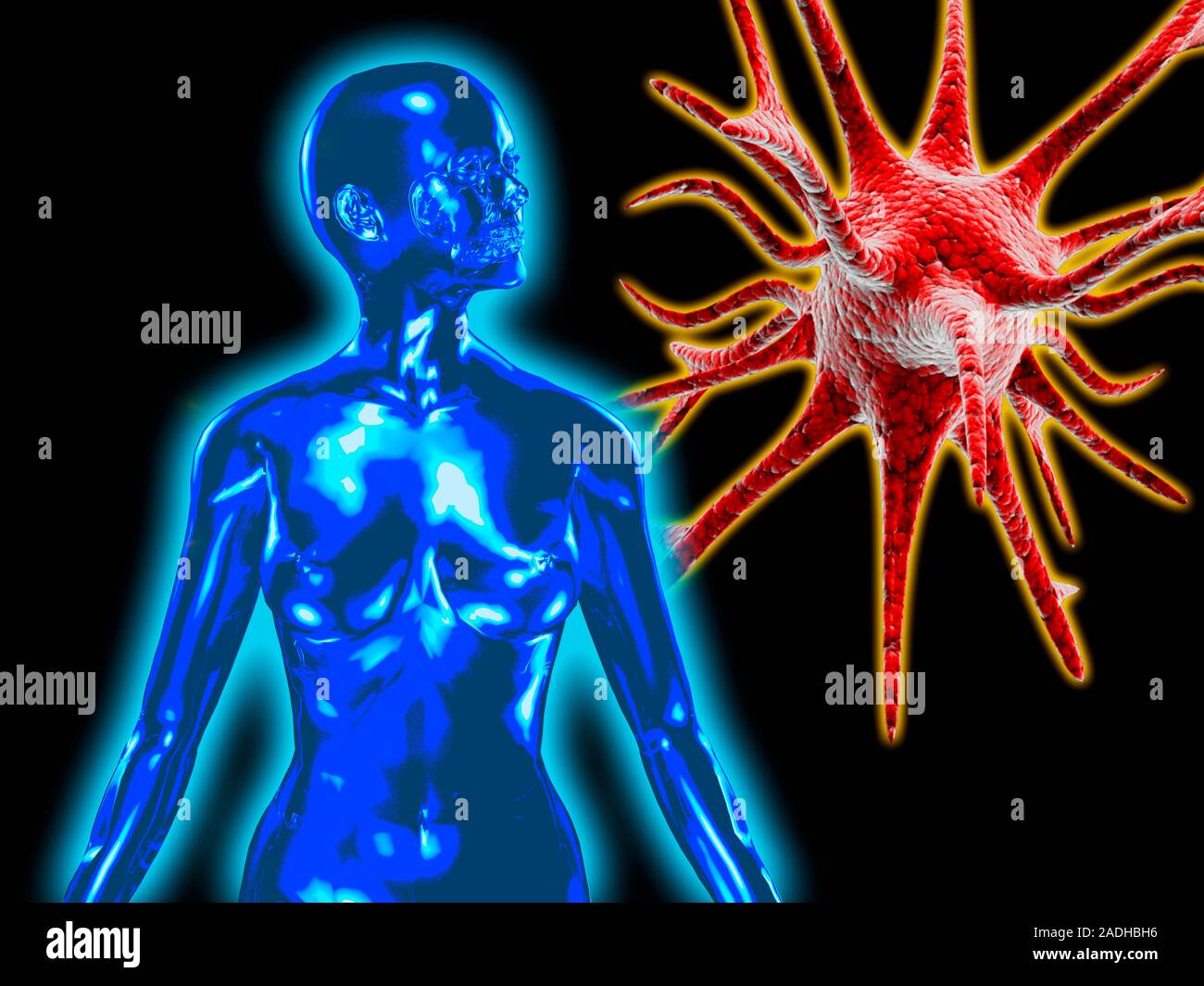 Cancer, computer artwork. A cancerous cell above a healthy man ...
