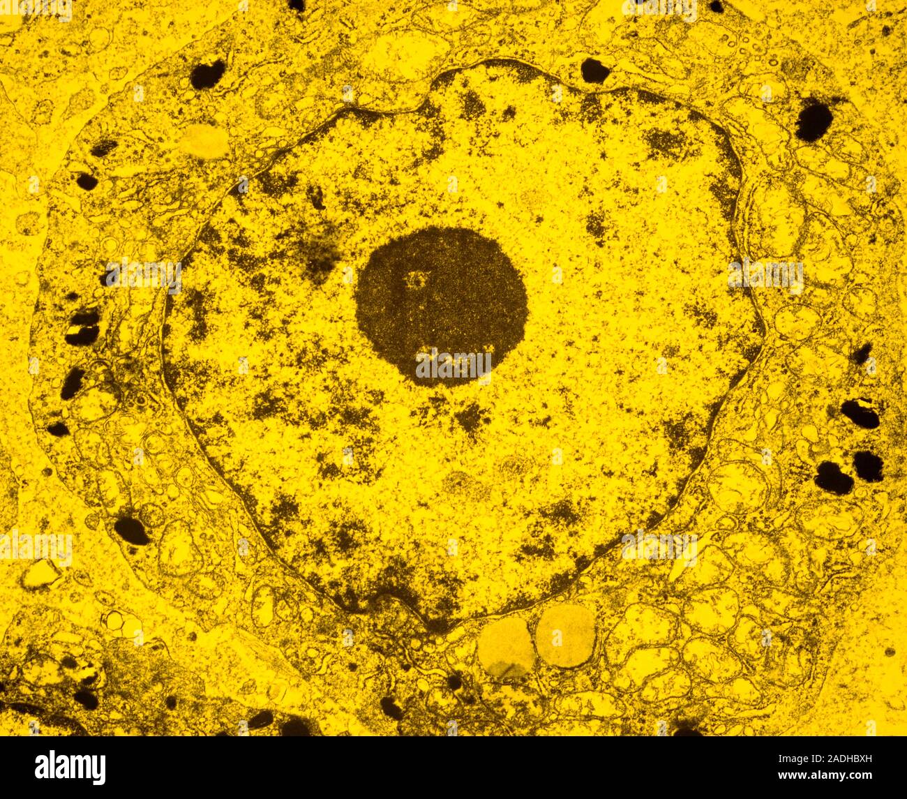 False-colour transmission electron micrograph (TEM) of a melanocyte, a ...