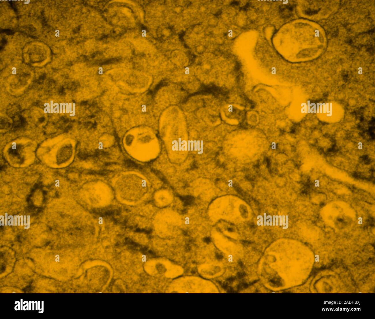 False-colour transmission electron micrograph (TEM) of melanosomes, the ...