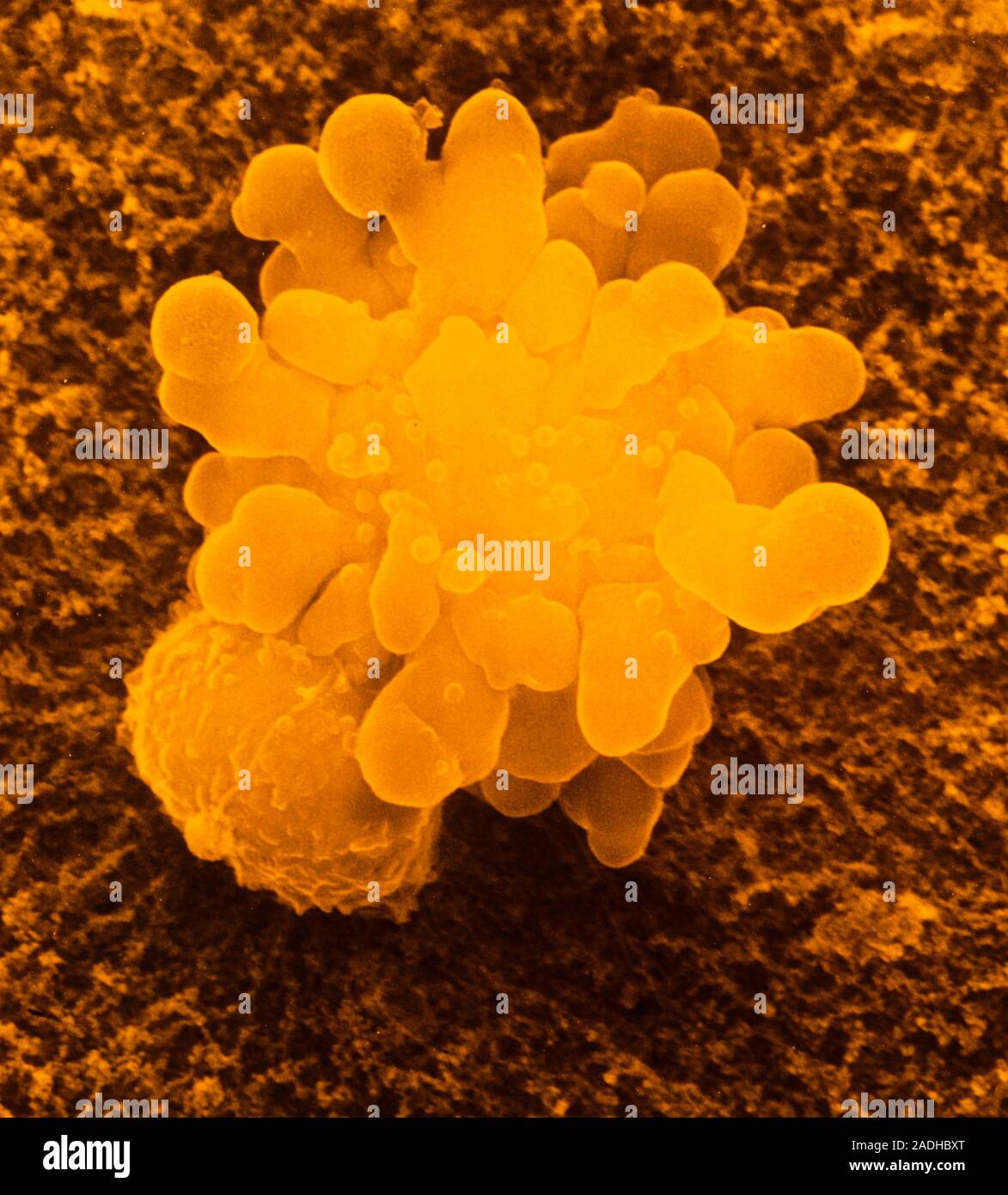 False-colour scannning electron micrograph of a T-lymphocyte killer ...