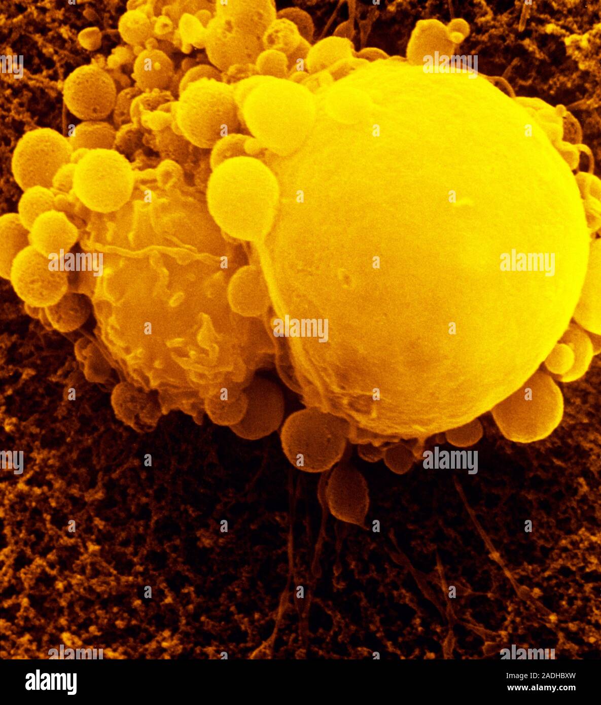 False-colour scannning electron micrograph of a T-lymphocyte killer ...