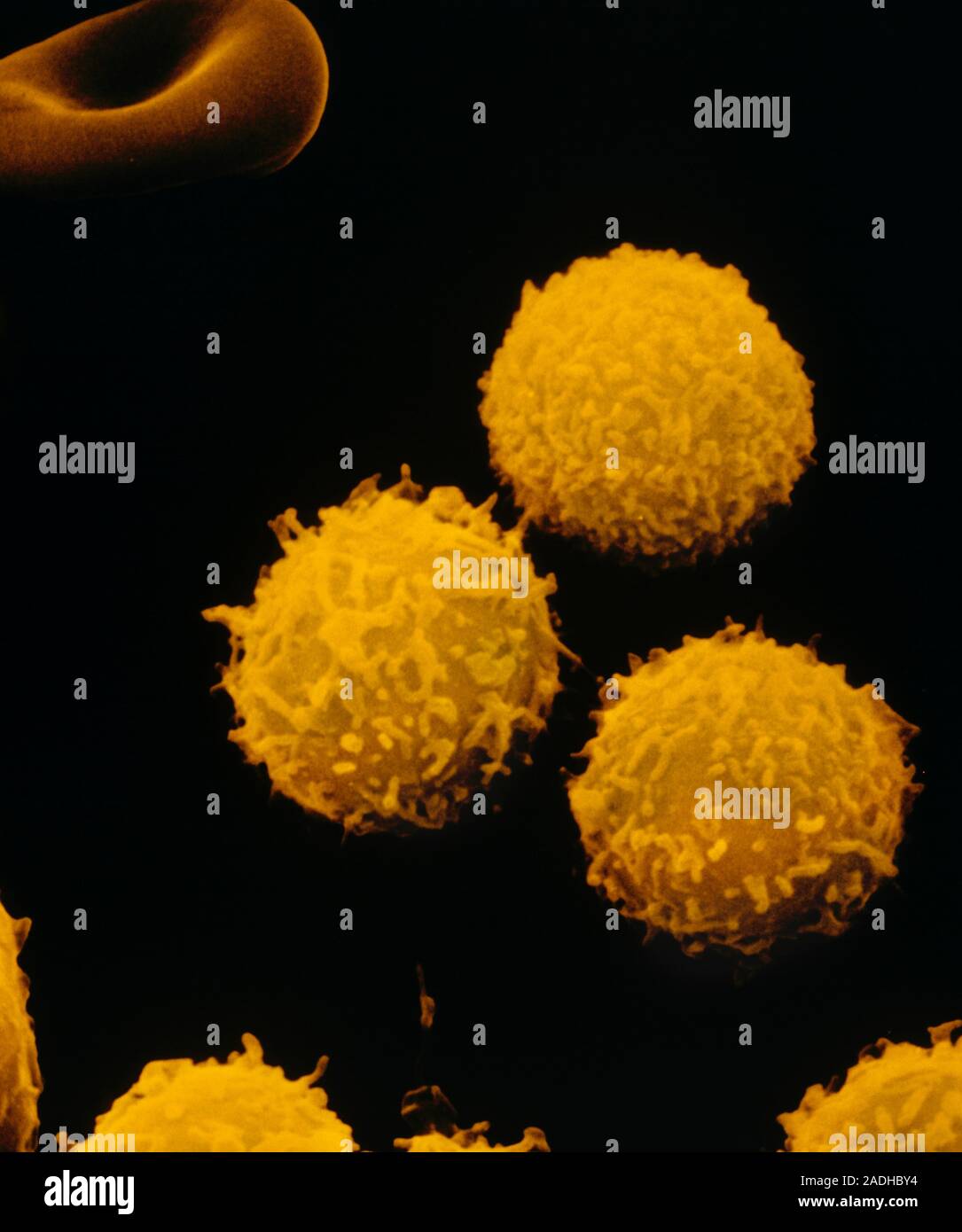 Scanning electron micrograph of human peripheral white blood cells ...