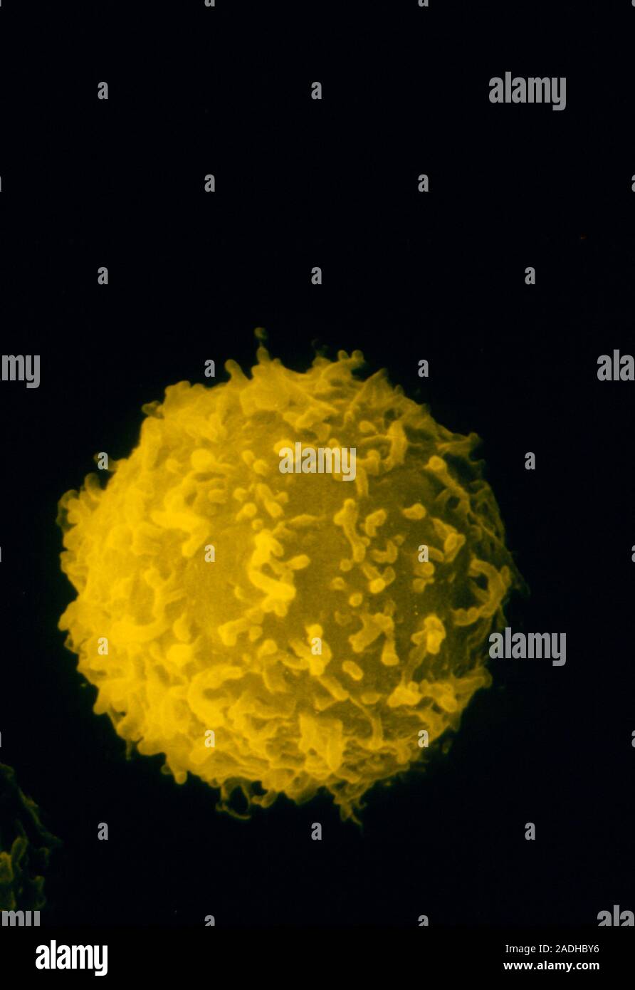 Scanning electron micrograph of a human peripheral white blood cell ...