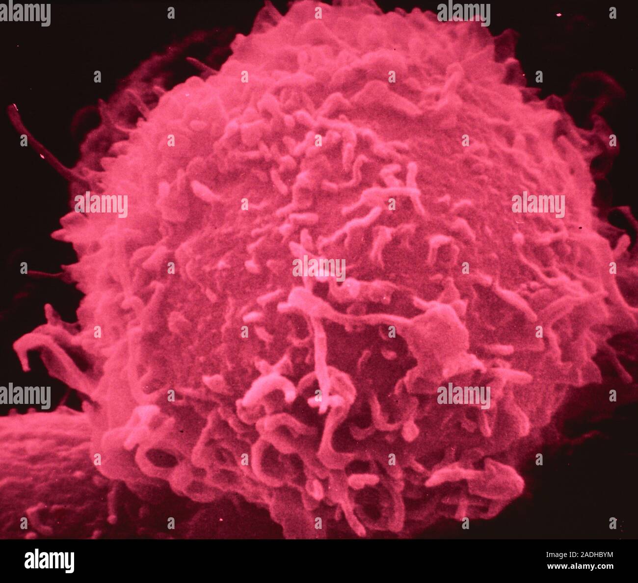 False-colour scanning electron micrograph of a lymphoblastoid cell, an ...