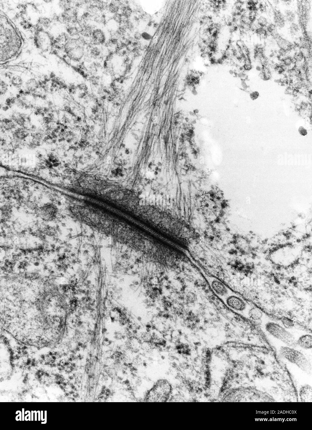Transmission electron micrograph of an inter- cellular junction or ...