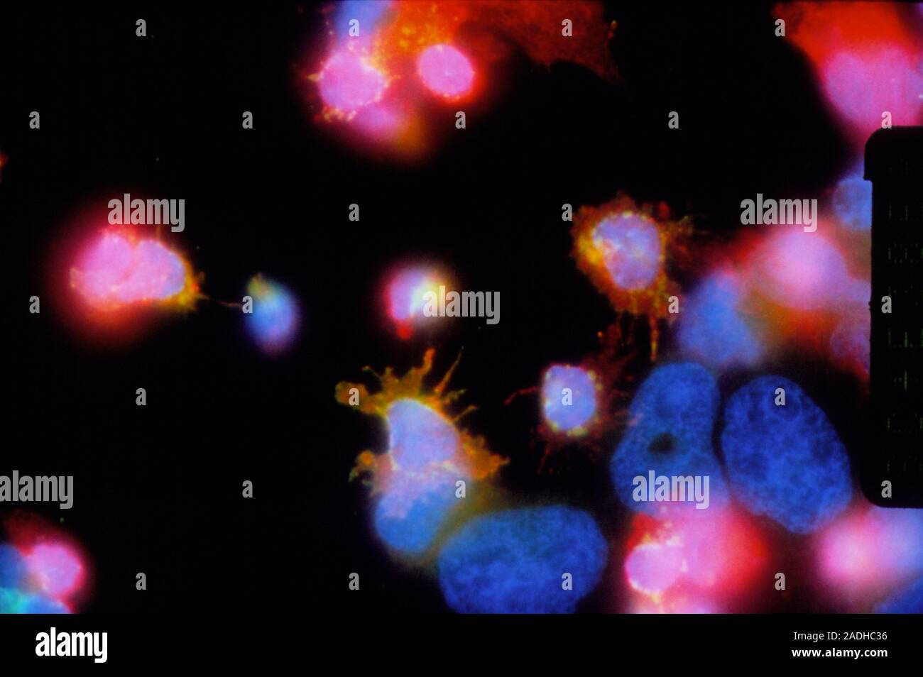 Natural killer (NK) cells. Immunofluorescent light micrograph of human ...
